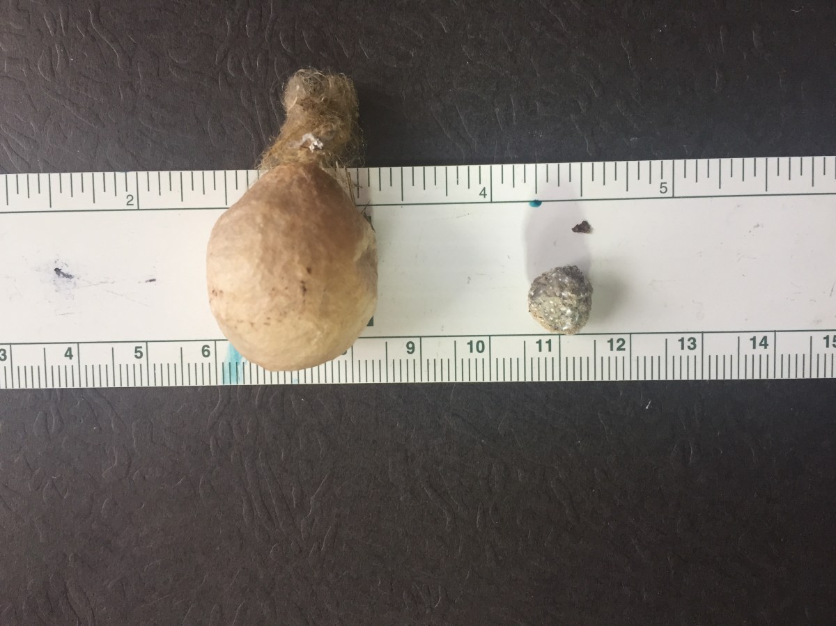 The Egg Sac Gallery – SpiderMentor